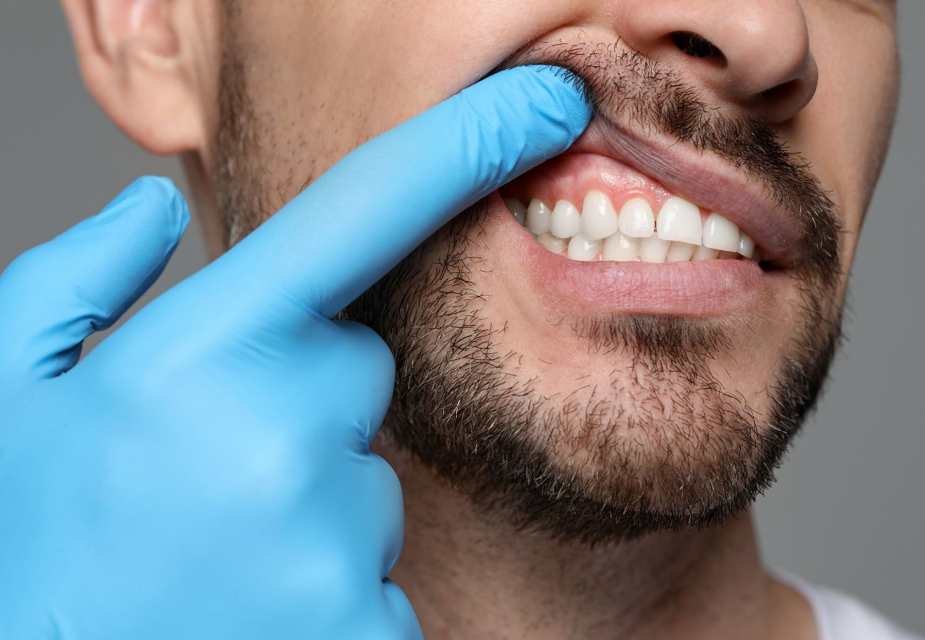 Periodontitis avanzada: Tratamientos profesionales - ZIGOMAT