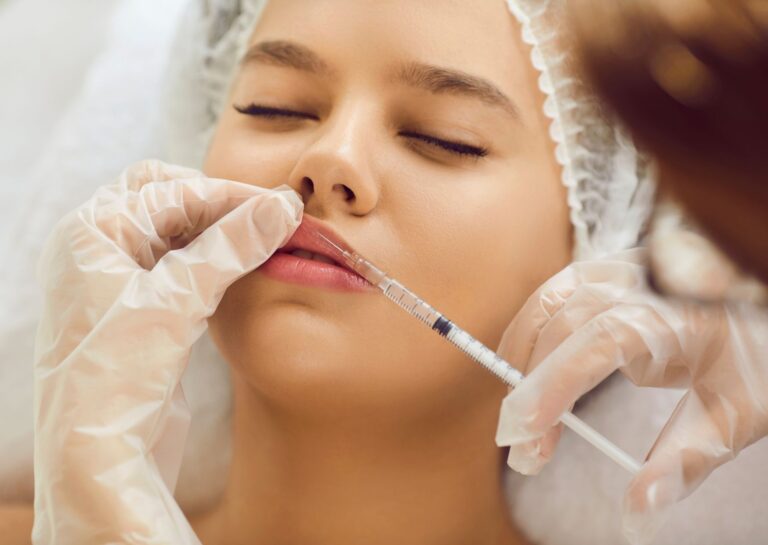 Botox para labios: cómo lograr un efecto natural - ZIGOMAT